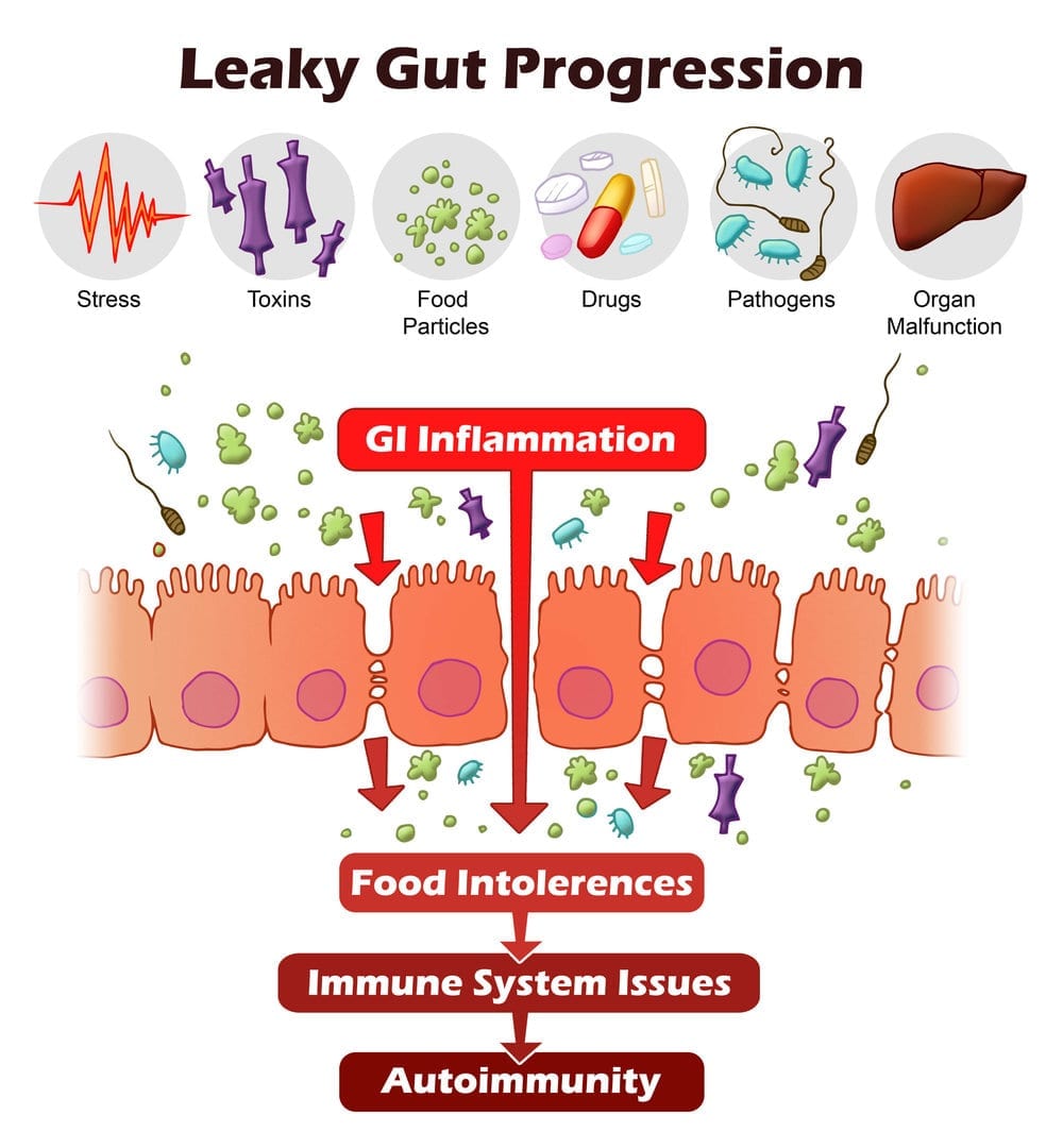A Deeper Dive In Understanding Intestinal Permeability (or Leaky Gut ...