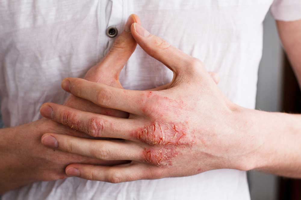 Gut Health and Skin Problems | Well Humans
