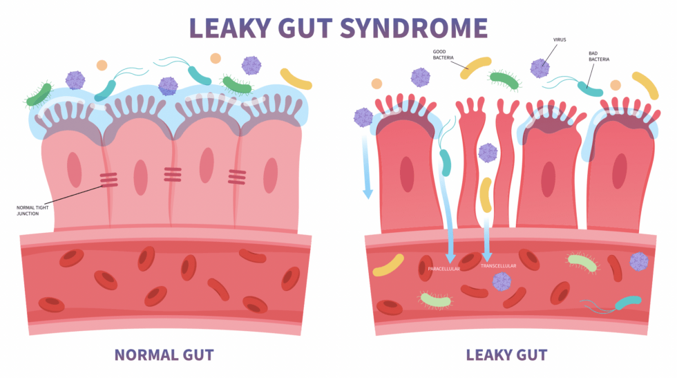 What Causes Leaky Gut - Well Humans